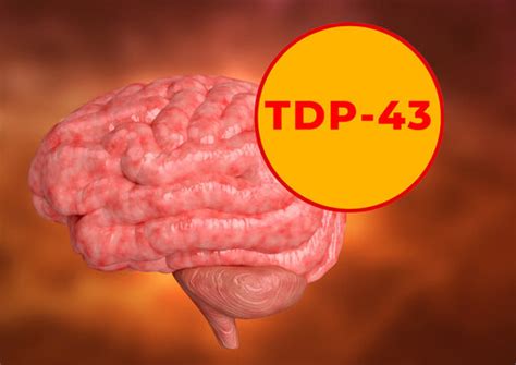 Tdp 이미지 – 찾아보기 545 스톡 사진, 벡터 및 비디오 | Adobe Stock