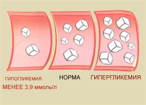 Низкий уровень сахара в крови