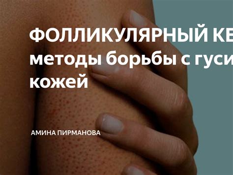 ФОЛЛИКУЛЯРНЫЙ КЕРАТОЗ: методы борьбы с гусиной кожей | Амина Пирманова ...