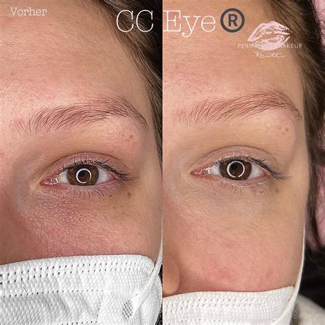 cc-eye-skin