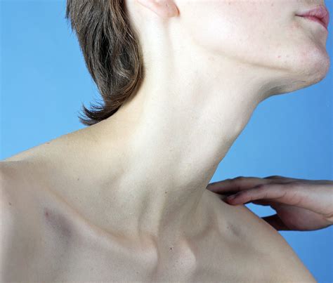 Necks | Edward Hillel