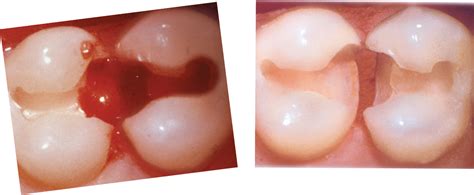 Viscostat & Viscostat Clear – DOE Vietnam – Chuyên cung cấp thiết bị ...