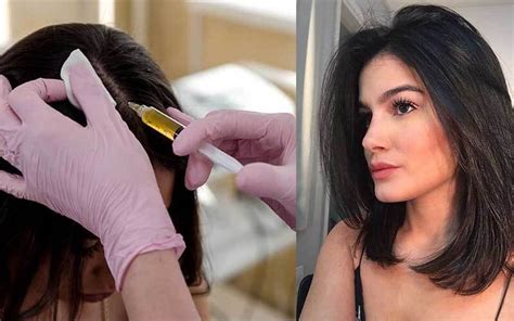 Плазмолифтинг для волос — Женский сайт WomanSovetnik — Полезные советы ...
