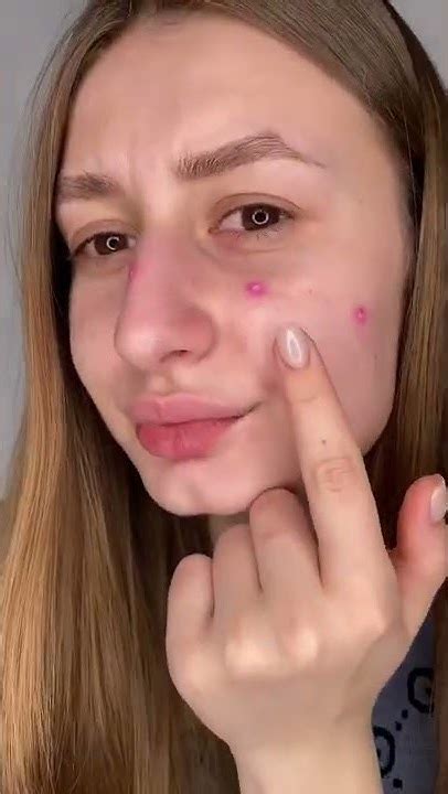Косметика от прыщей #прыщи #черныеточки - YouTube