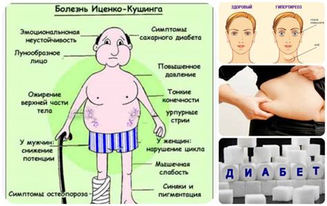 Как снизить гормон кортизол у женщин народными средствами