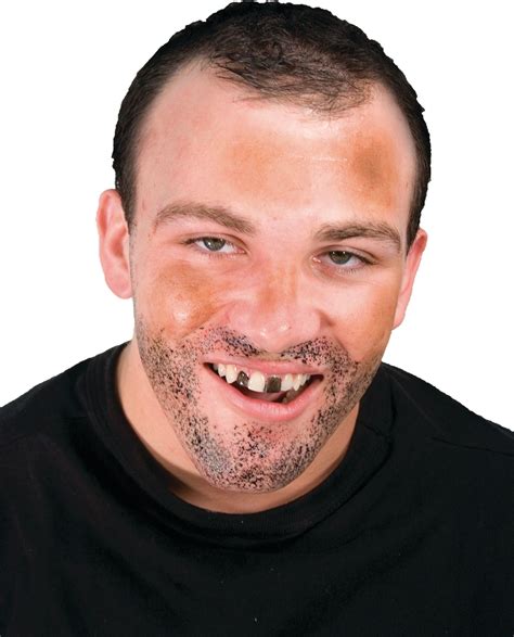Temporary Tooth Colour | Party City