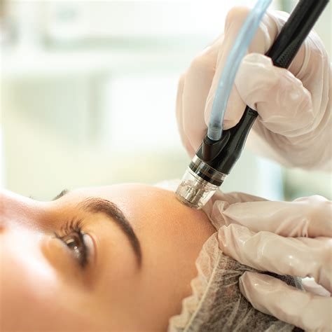 Hydrafacial - Milabisous SkinCare