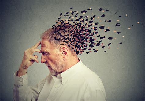 Amnesia : Causes, Symptoms, Diagnosis, Treatment, and Prevention