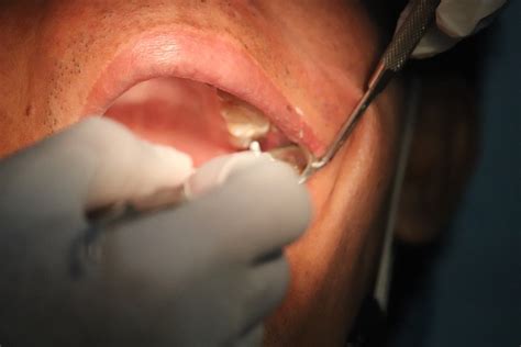 Teeth And Mouth Dental Clinic - Free photo on Pixabay - Pixabay