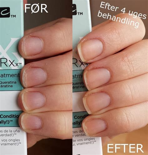 CND Rescue RXx Daily Keratin Treatment 15 ml | Nicehands