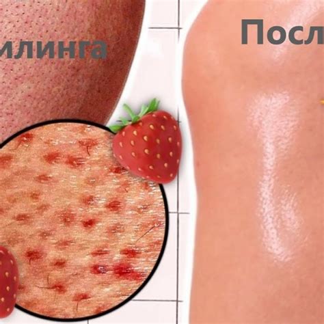 Скраб для тела. Мочалка варежка для пилинга тела. - YouTube
