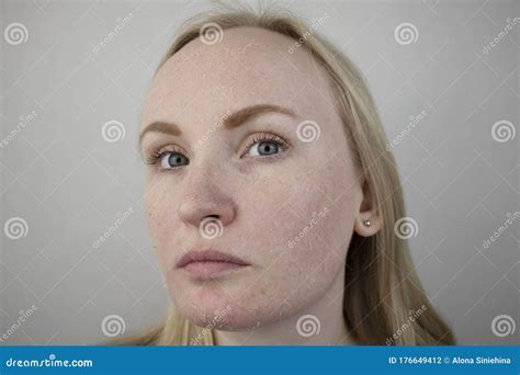 Женщина считает сухую кожу на лице. К чистке Coarsening ...