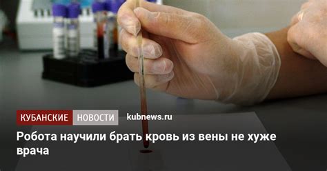 Робота научили брать кровь из вены не хуже врача