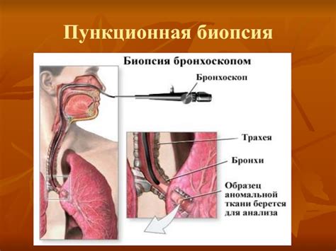 Биопсия презентация, доклад