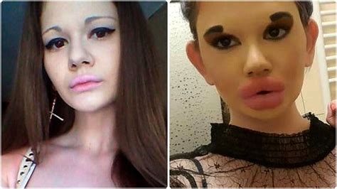 Душа требует перемен: женщина с самыми большими губами в мире ...
