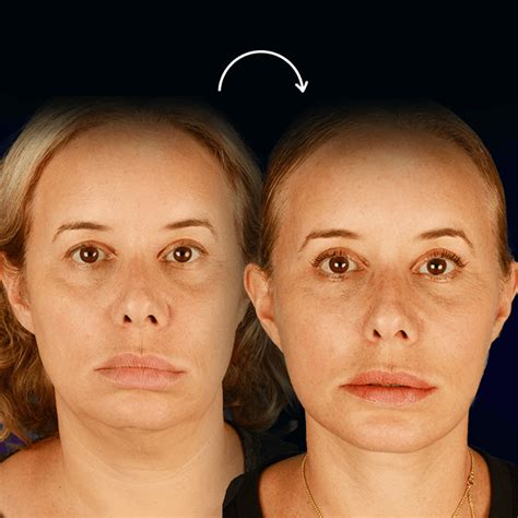 Novomed - The Largest Surgical, Cosmetic and Wellness Provider
