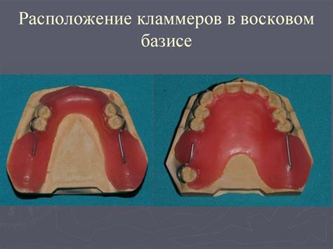 Изготовление проволочных кламмеров - презентация онлайн