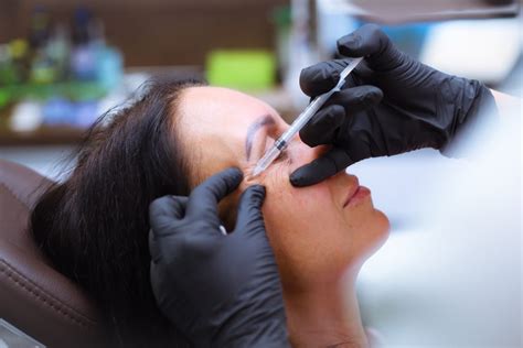 Estetická dermatológia – Milvus Dent s.r.o.