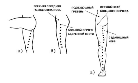 Массаж седалищного нерва: польза, показания, виды и техника выполнения