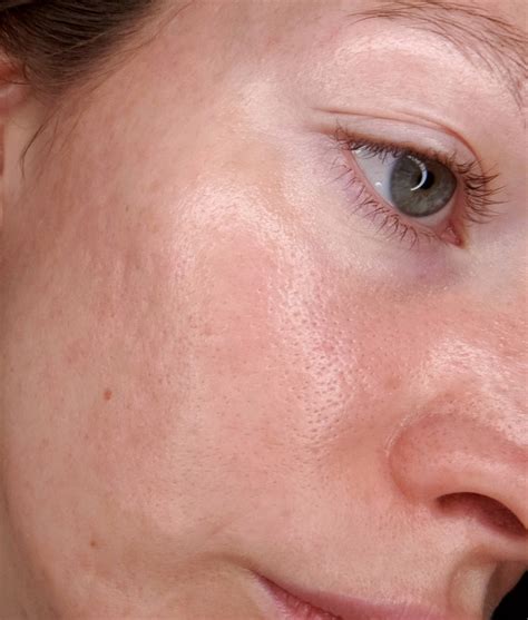 Darling* Skin relief увлажняющий успокаивающий сорбет для лица | Отзывы ...