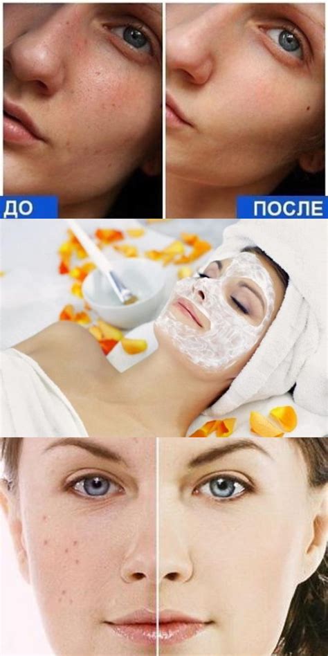 Глубокая чистка лица за 1 процедуру.