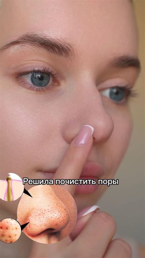 Чистим поры 🙌 Идеальный УЗ-скраббер для очищения кожи🤍 Сохраняйте ...