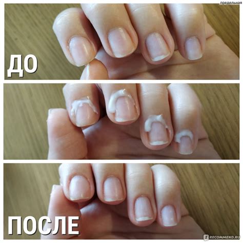 Средство для удаления кутикулы Белита-Витэкс PRO Pedicure - «Средство ...