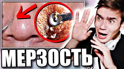 Удаление чёрных точек на лице |МЕРЗОСТЬ| - YouTube