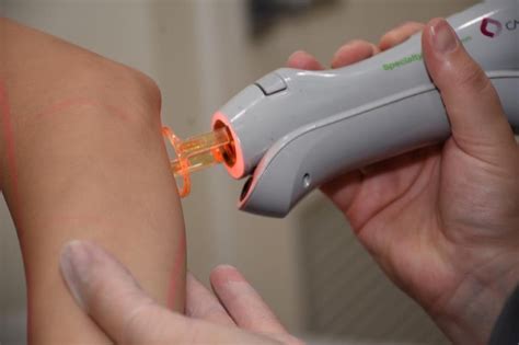 Evolution Laser Clinic - Chatswood: Lees recensies en boek lessen met ...