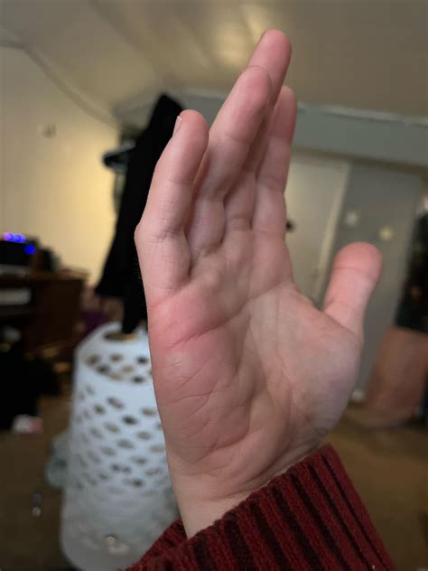 Haha big bite could this be? : r/bugbites