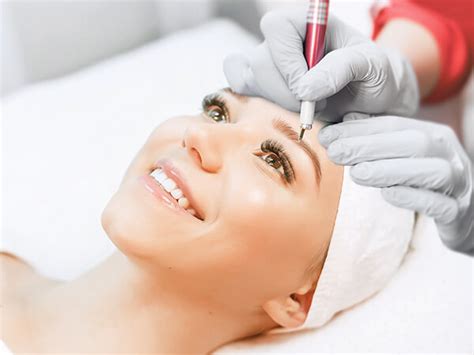 Vitiligo Treatments at Sood Aesthetics and Hair Solutions