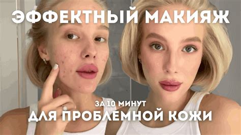 МАКИЯЖ ДЛЯ ПРОБЛЕМНОЙ КОЖИ // КАК СКРЫТЬ АКНЕ, ПРЫЩИ БЮДЖЕТНЫМИ ...