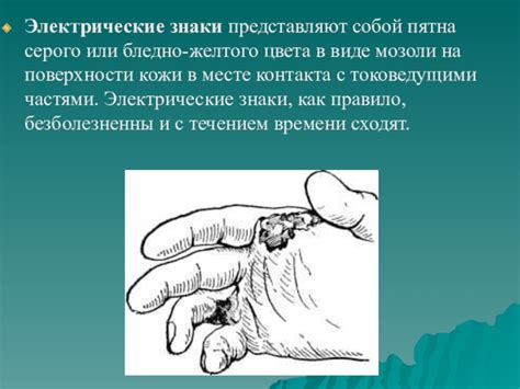 Презентация по охране труда на тему Поражение электрическим током ...