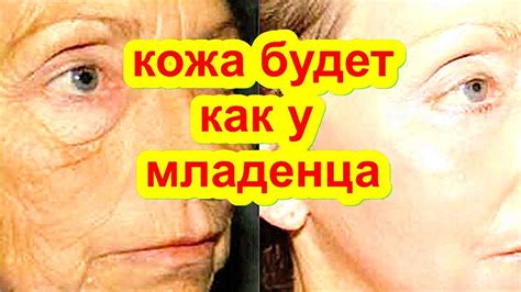 ЗОЛОТАЯ Маска УБЕРЁТ Все Морщины даже в 60 лет ! НАТУРАЛЬНЫЙ Коллаген ...