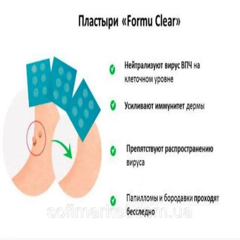 Пластырь от папиллом: особенности и применение