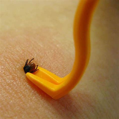 Tick Twister Tick Remover Set – NoveltyStreet
