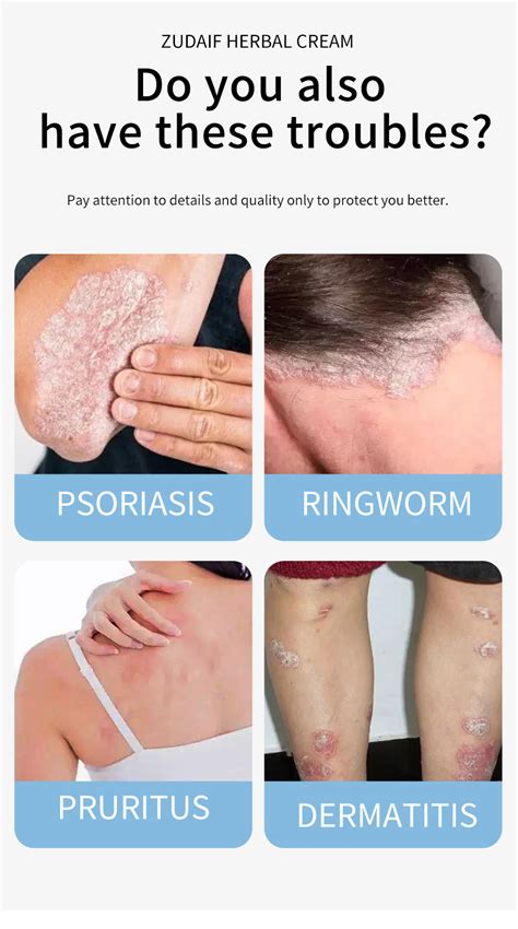 ZUDAIFU 3rd Generation Cream is a natural topical treatment made from ...