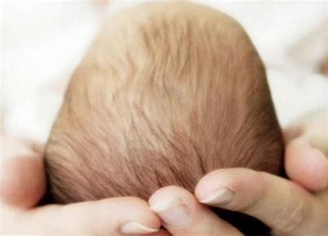 Большой родничок у ребенка