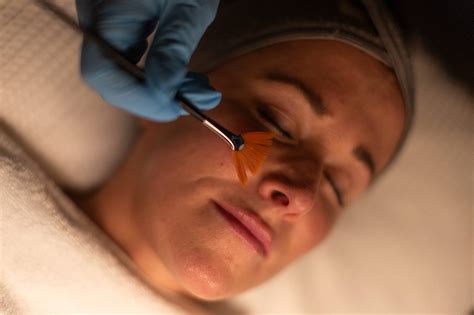 Medical Peels - Kaya Cosmedica