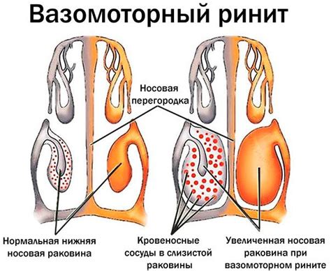 Капли в нос от заложенности носа. Список для детей от 1-3-6 лет, цены
