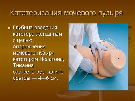 Катетеризация мочевого пузыря - презентация онлайн
