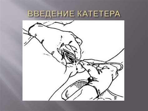 Катетеризация мочевого пузыря - презентация онлайн
