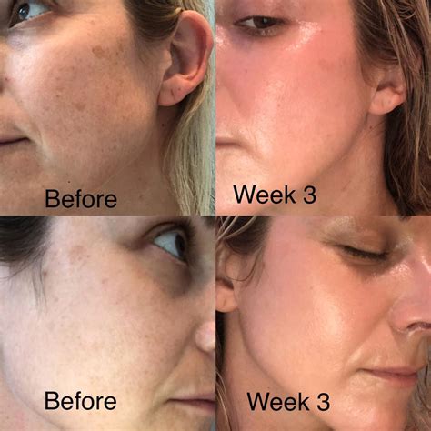 Dermscapes Medical Spa, ZO Skin Health Inc Bakersfield CA