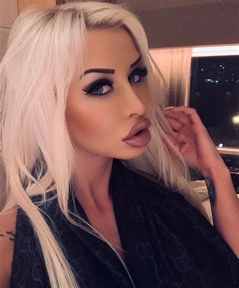 Модель Playboy вбухала в пластику $66 000, и вот что из нее вылепили