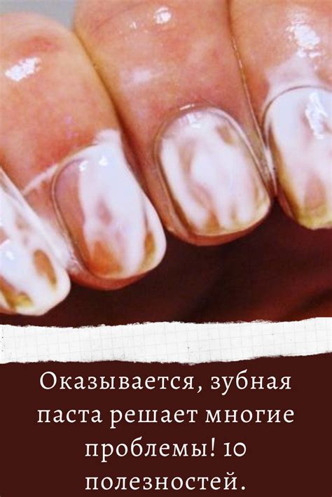 Оказывается, зубная паста решает многие проблемы! 10 полезностей ...