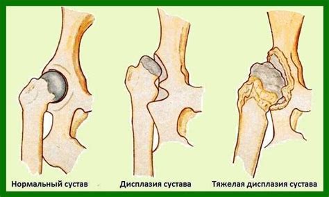 Подушка Фрейка для новорожденных: показания, как сделать своими руками