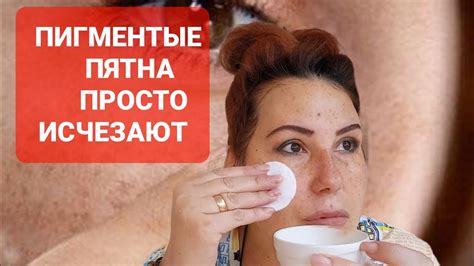 Убираю все Пигментные пятна с лица. Простая маска от пигментации. - YouTube