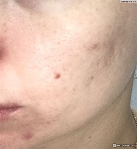 CC Cream Erborian Red correct - «Erborian cc red correct» | отзывы