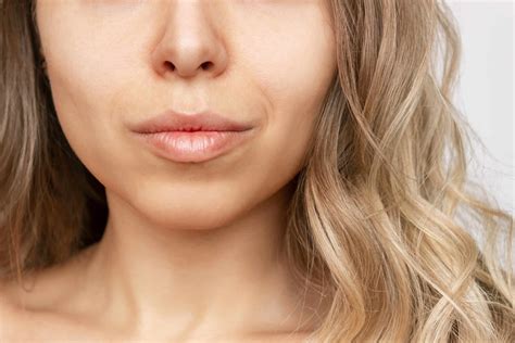 5 Things to Know About Buccal Fat Removal Surgery