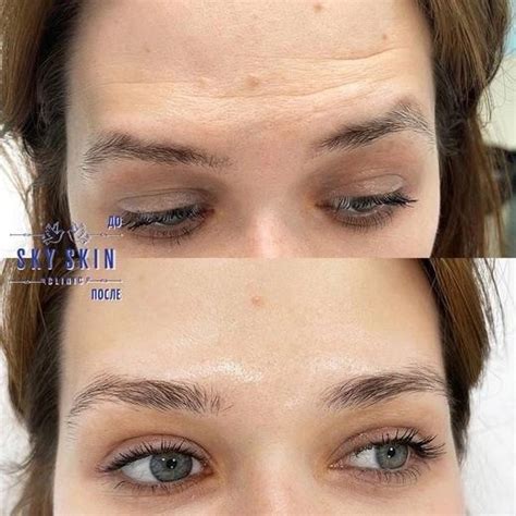 SkySkin | Лазерная эпиляция и косметология в СПБ | ВКонтакте